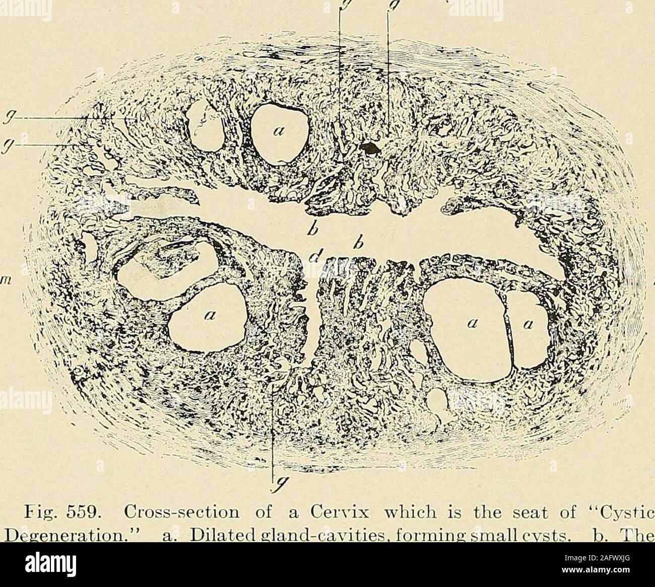 Posterior cervix hi-res stock photography and images - Alamy