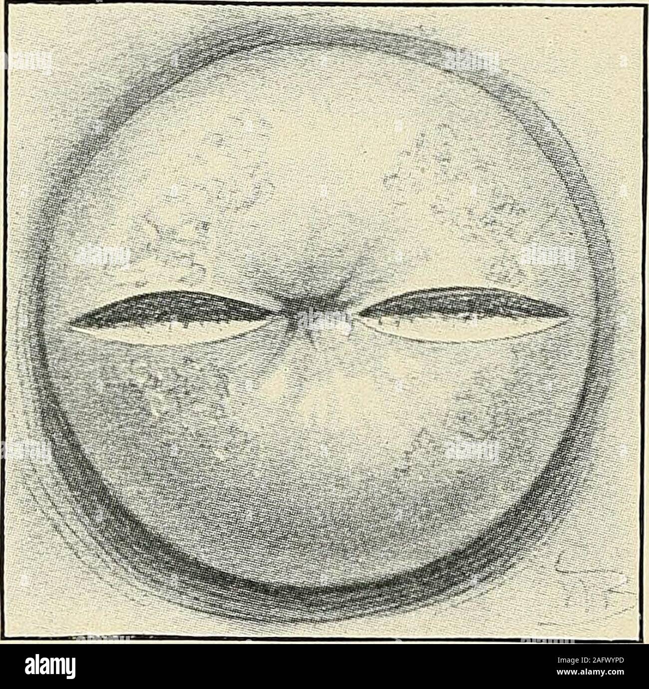 Cervical incision hi-res stock photography and images - Alamy