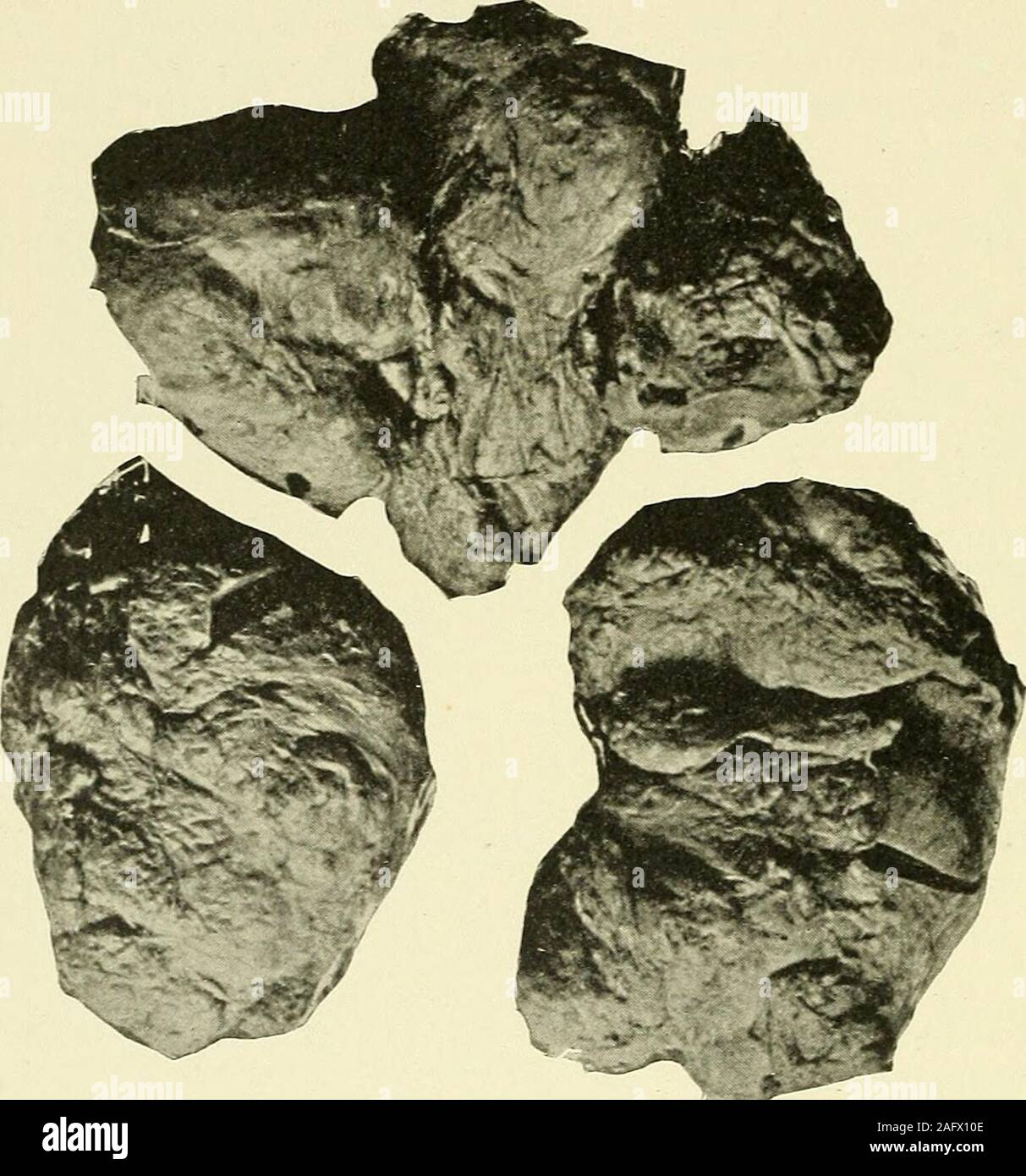 Cystoscope hi-res stock photography and images - Alamy