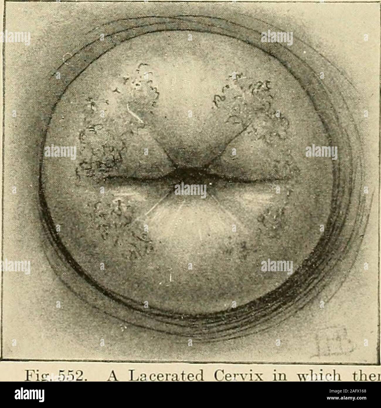 . The diagnosis and treatment of diseases of women. ce of theswollen ...