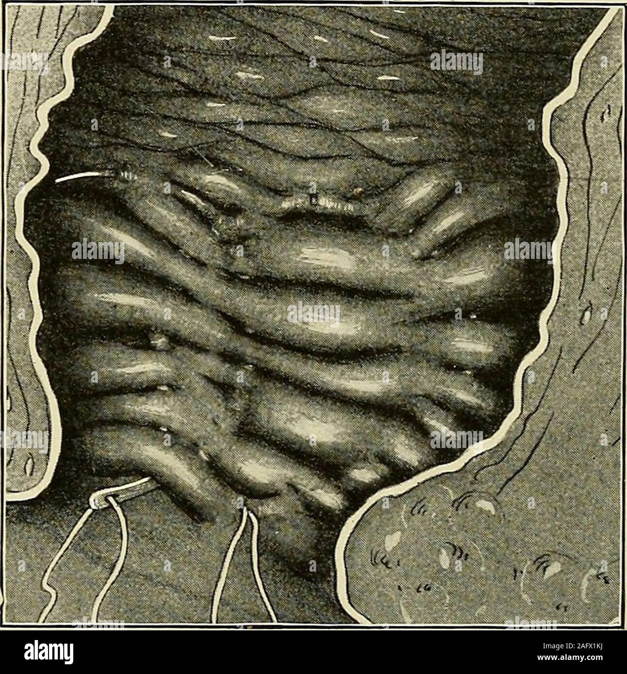 . Diseases of the rectum and anus: designed for students and ...