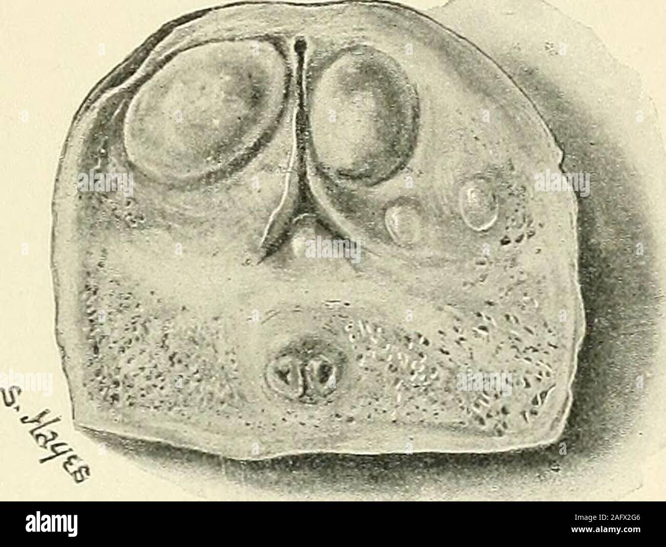 . Studies on hypertrophy and cancer of the prostate. Fig. H. Fig. I ...