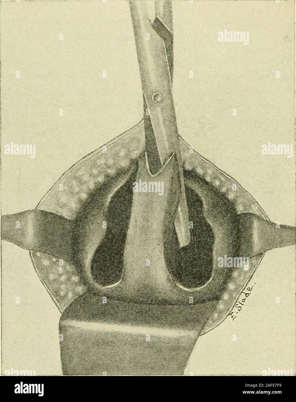 Calculus bridge hi-res stock photography and images - Alamy