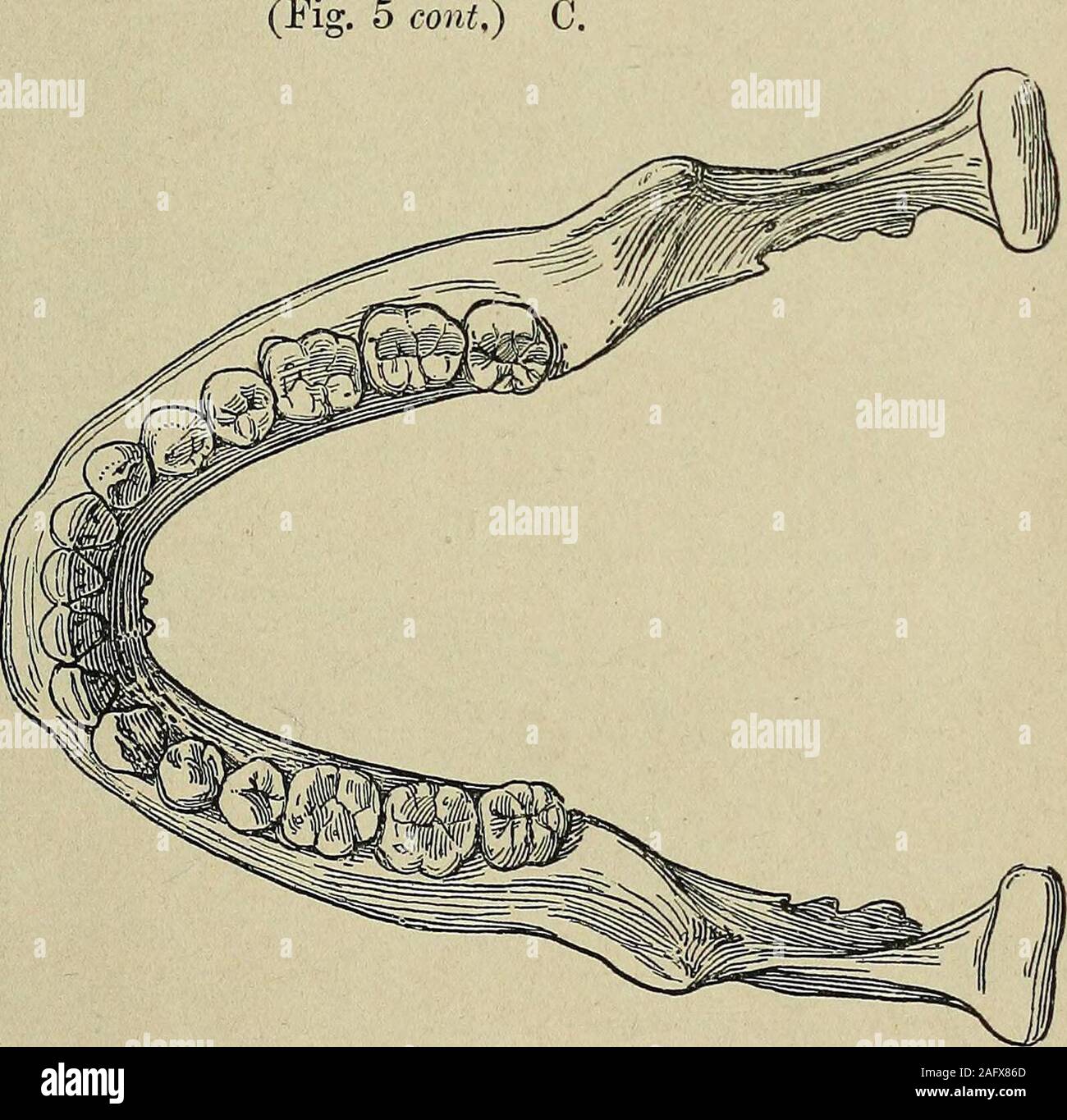 Elongated human skull hi-res stock photography and images - Alamy