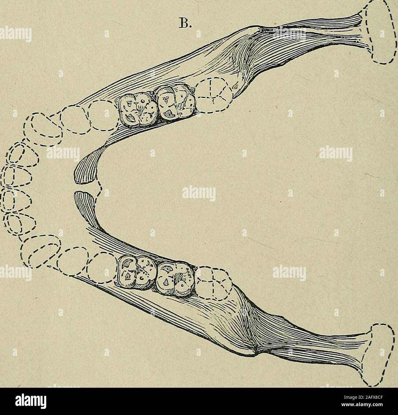 Elongated human skull hi-res stock photography and images - Alamy