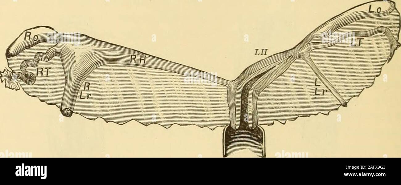 Round ligament of uterus hi-res stock photography and images - Alamy