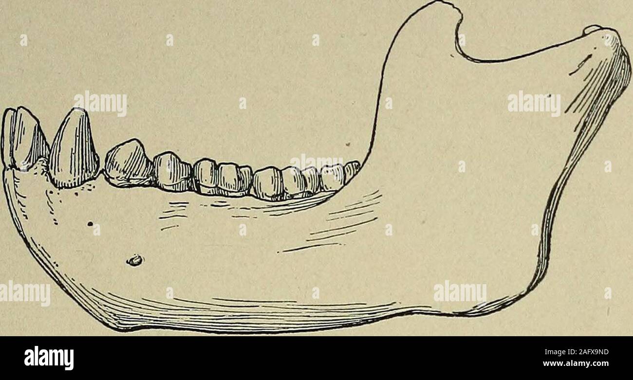 Human jaw wide hi-res stock photography and images - Alamy