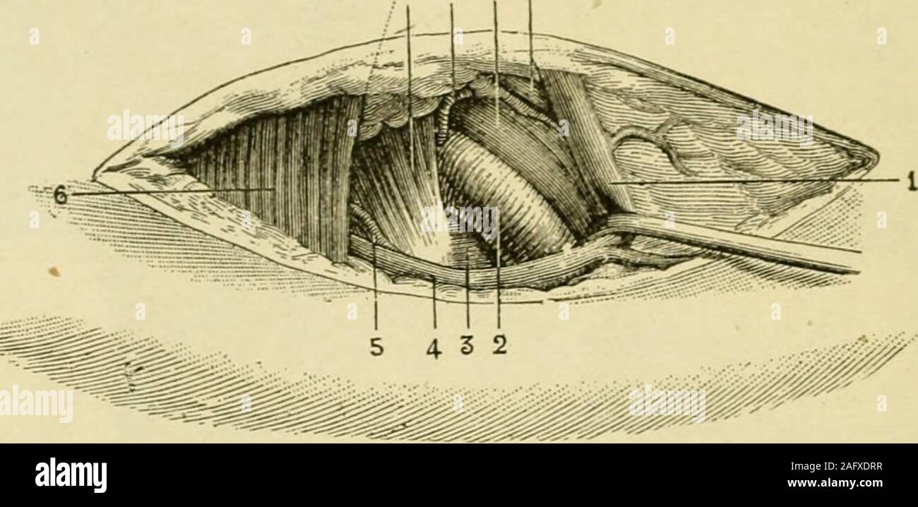 Cervical ganglion hi-res stock photography and images - Alamy