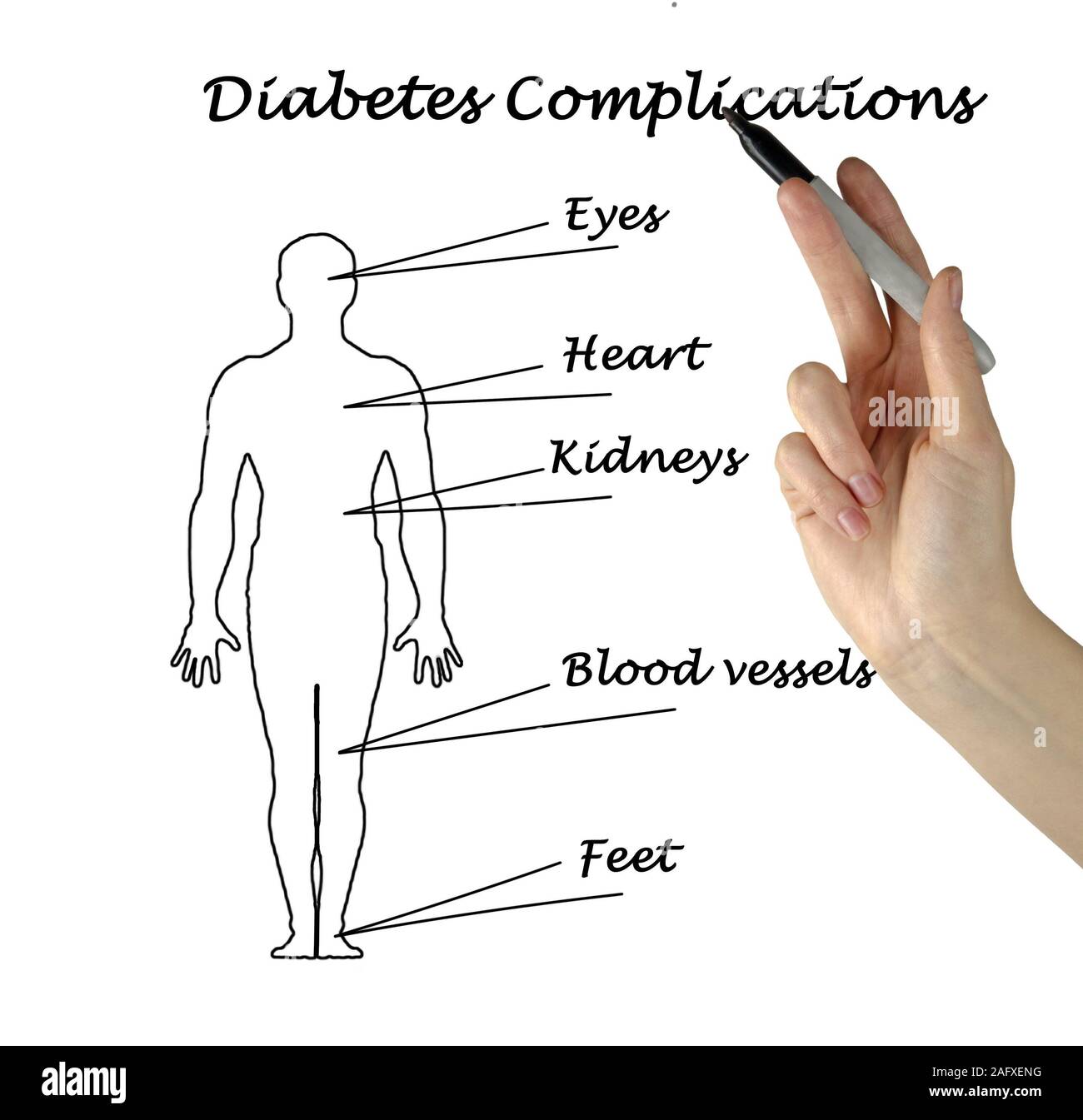 Diabetes mellitus doctor Cut Out Stock Images & Pictures - Alamy