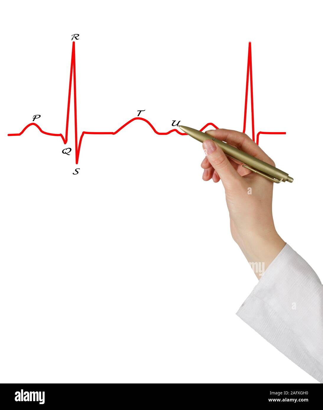 Qrs wave hi-res stock photography and images - Alamy