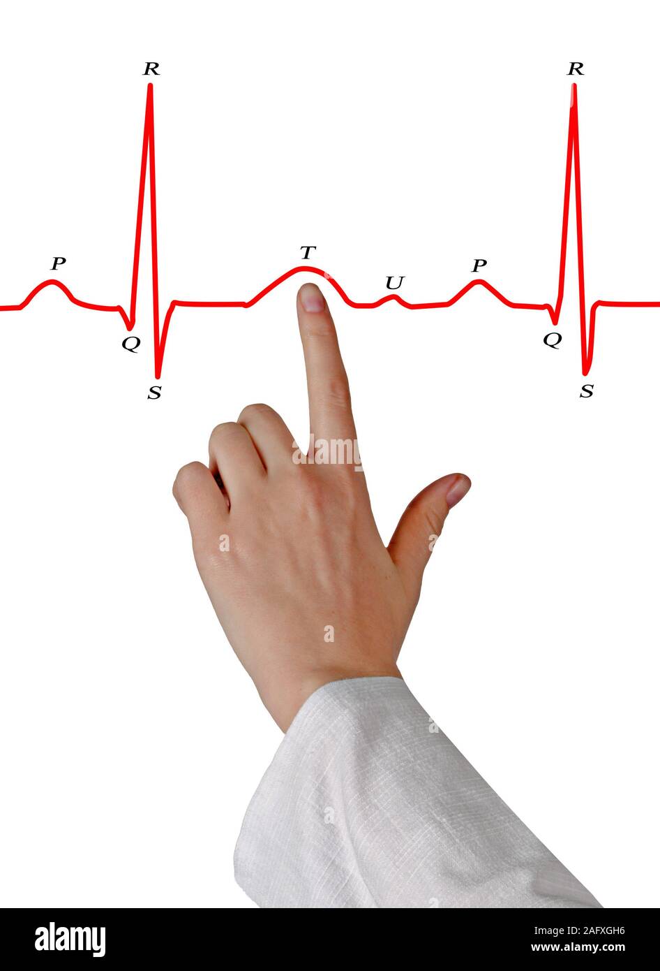 Doctor drawing ecg heartbeat hi-res stock photography and images - Alamy