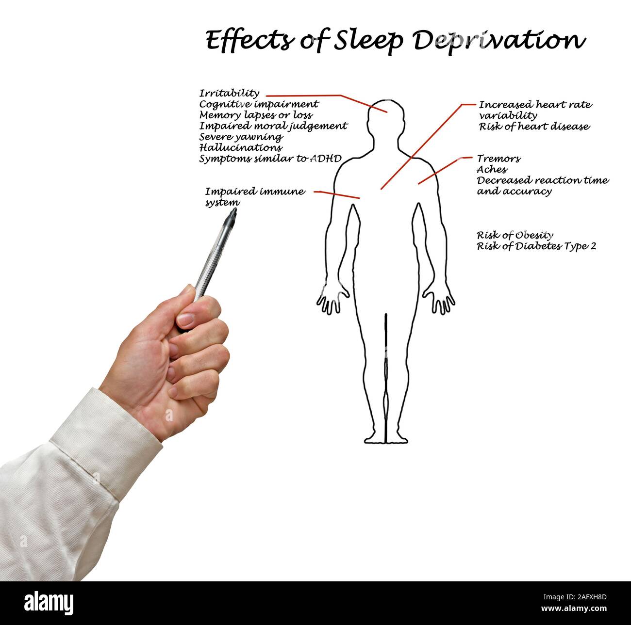 Effects of Sleep Deprivation Stock Photo - Alamy