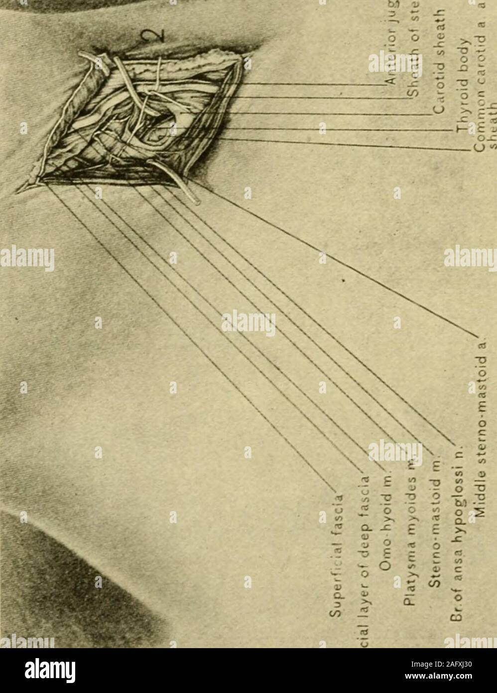 . Manual of operative surgery. us nerve lies behind and between ...
