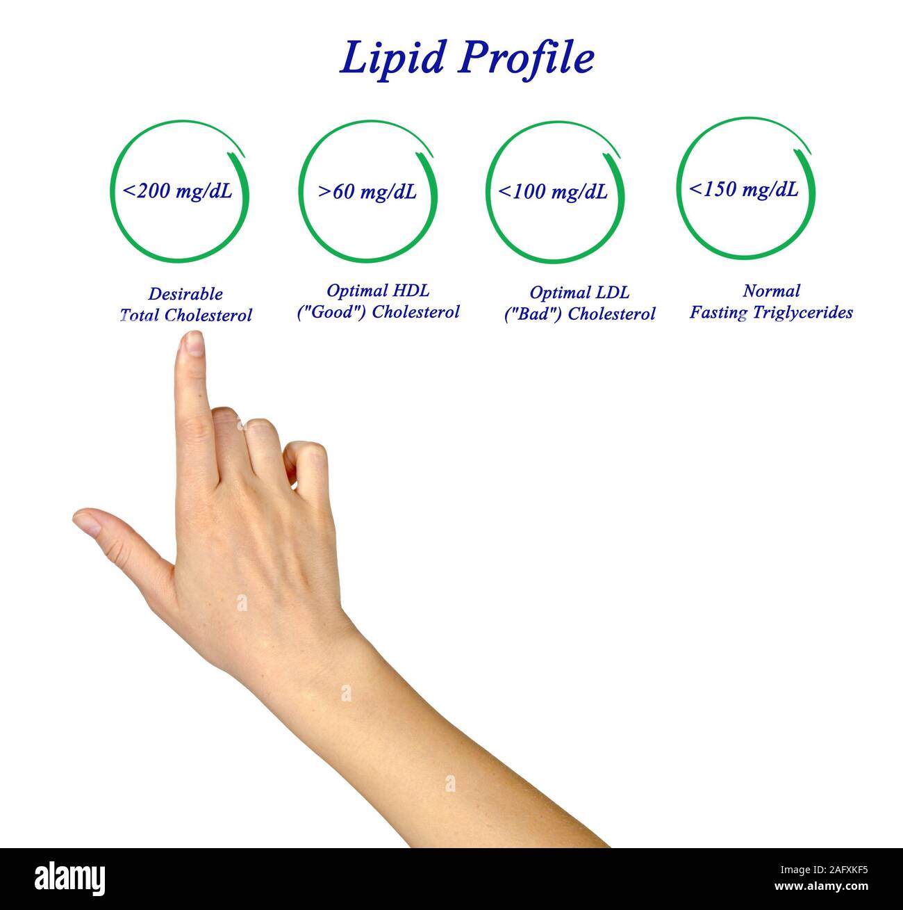 Diagram of Lipid profile Stock Photo - Alamy