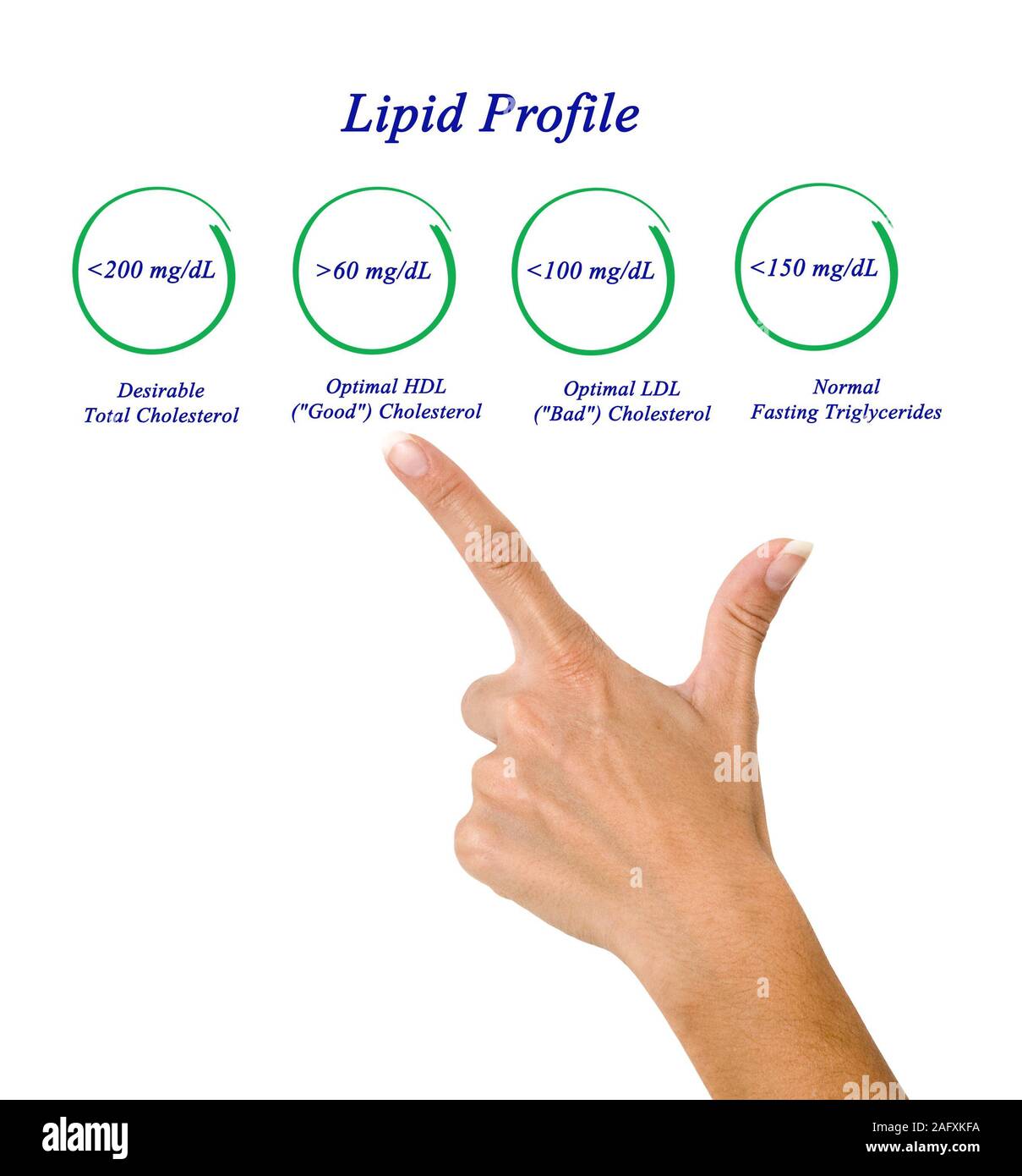 Lipid profile hi-res stock photography and images - Alamy