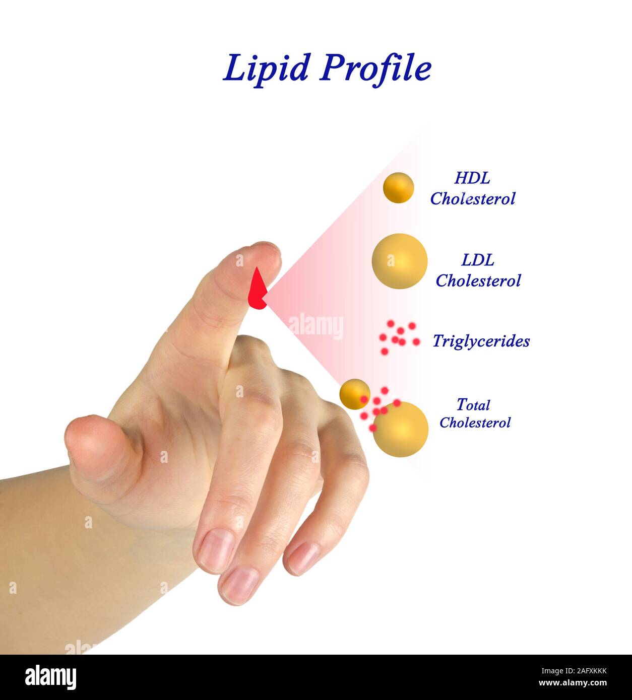 Lipid profile test hi-res stock photography and images - Alamy
