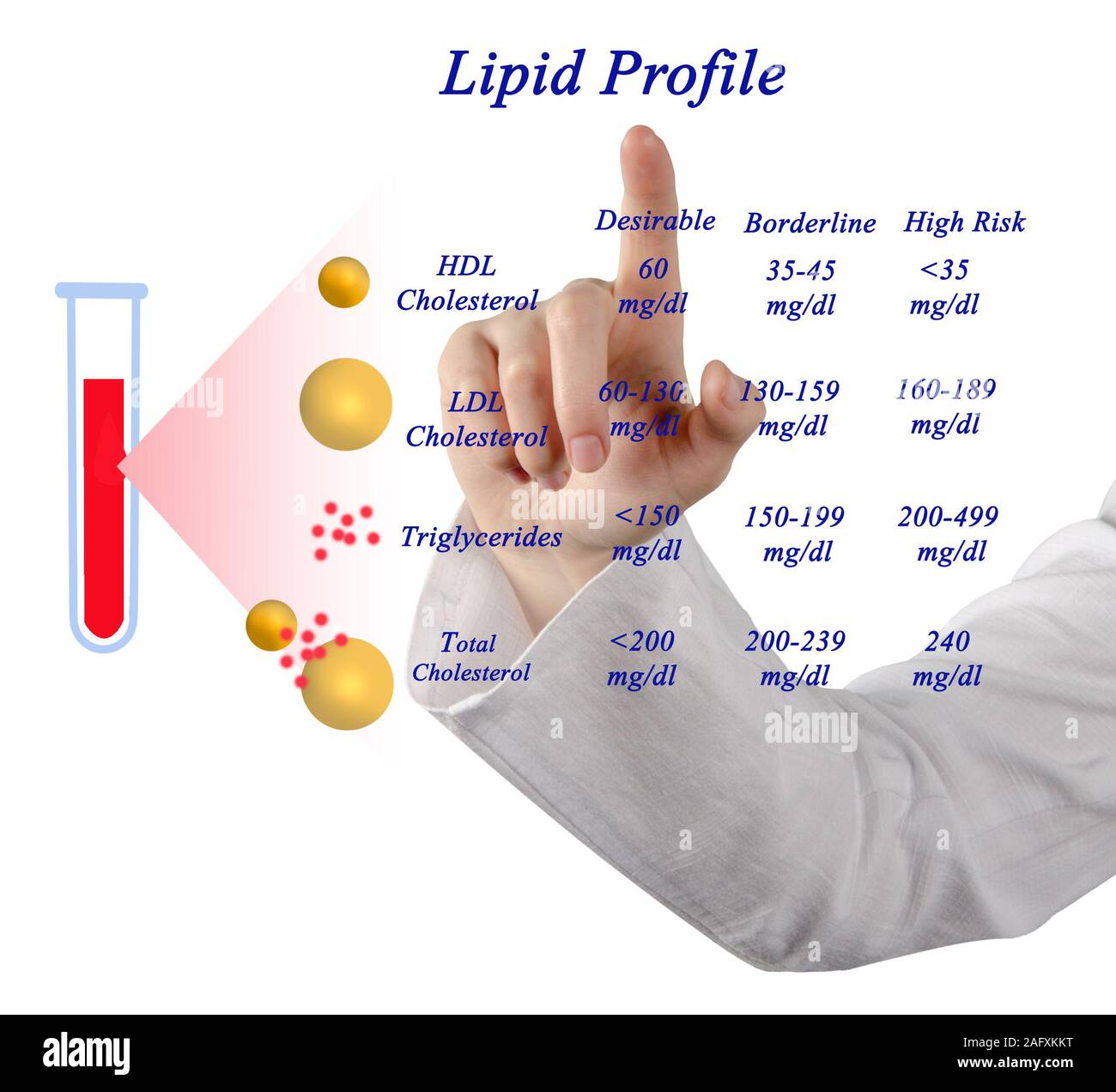 Lipid profile hi-res stock photography and images - Alamy