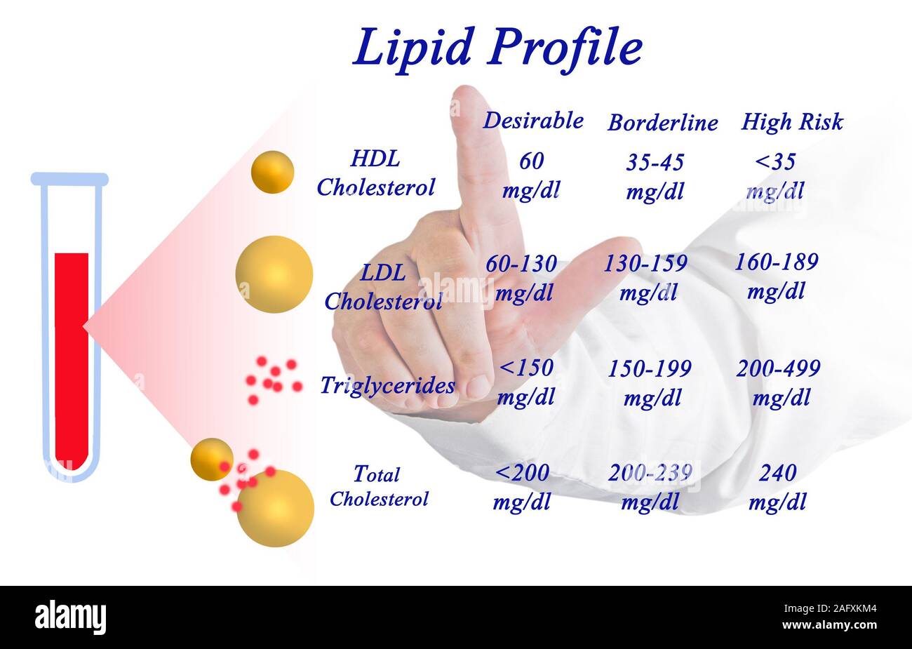 Lipid profile hi-res stock photography and images - Alamy