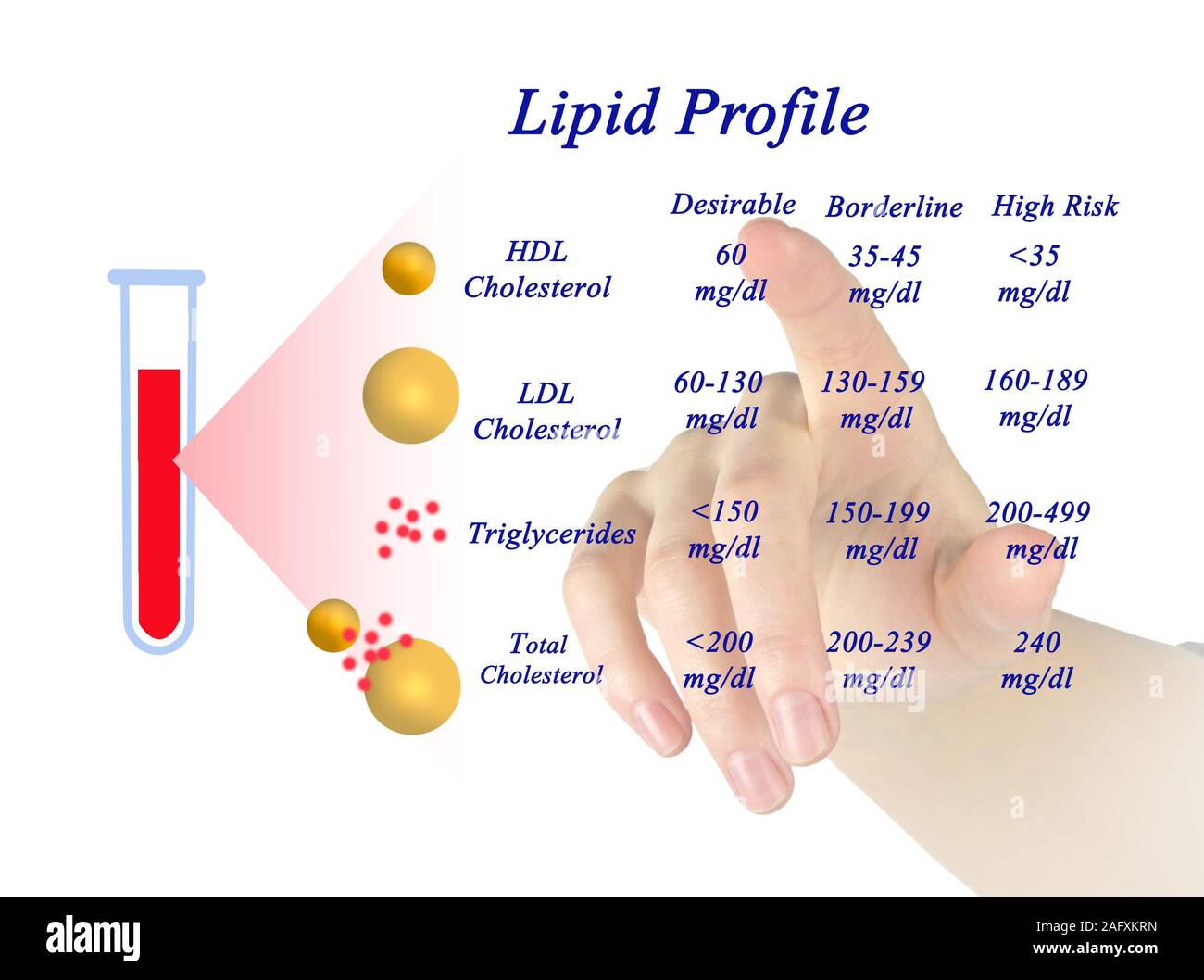 Lipid profile hi-res stock photography and images - Alamy