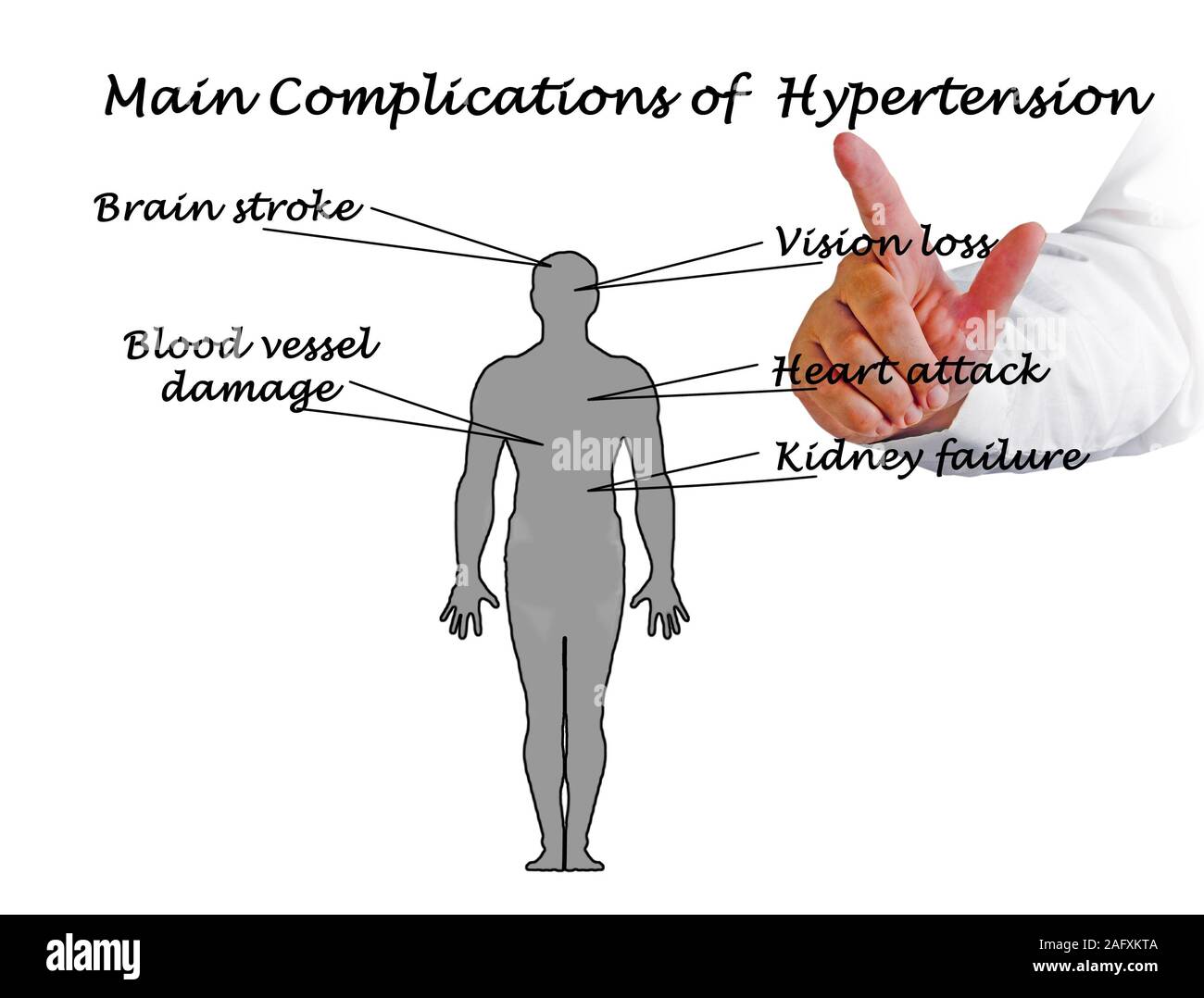 main complications of hypertension Stock Photo - Alamy