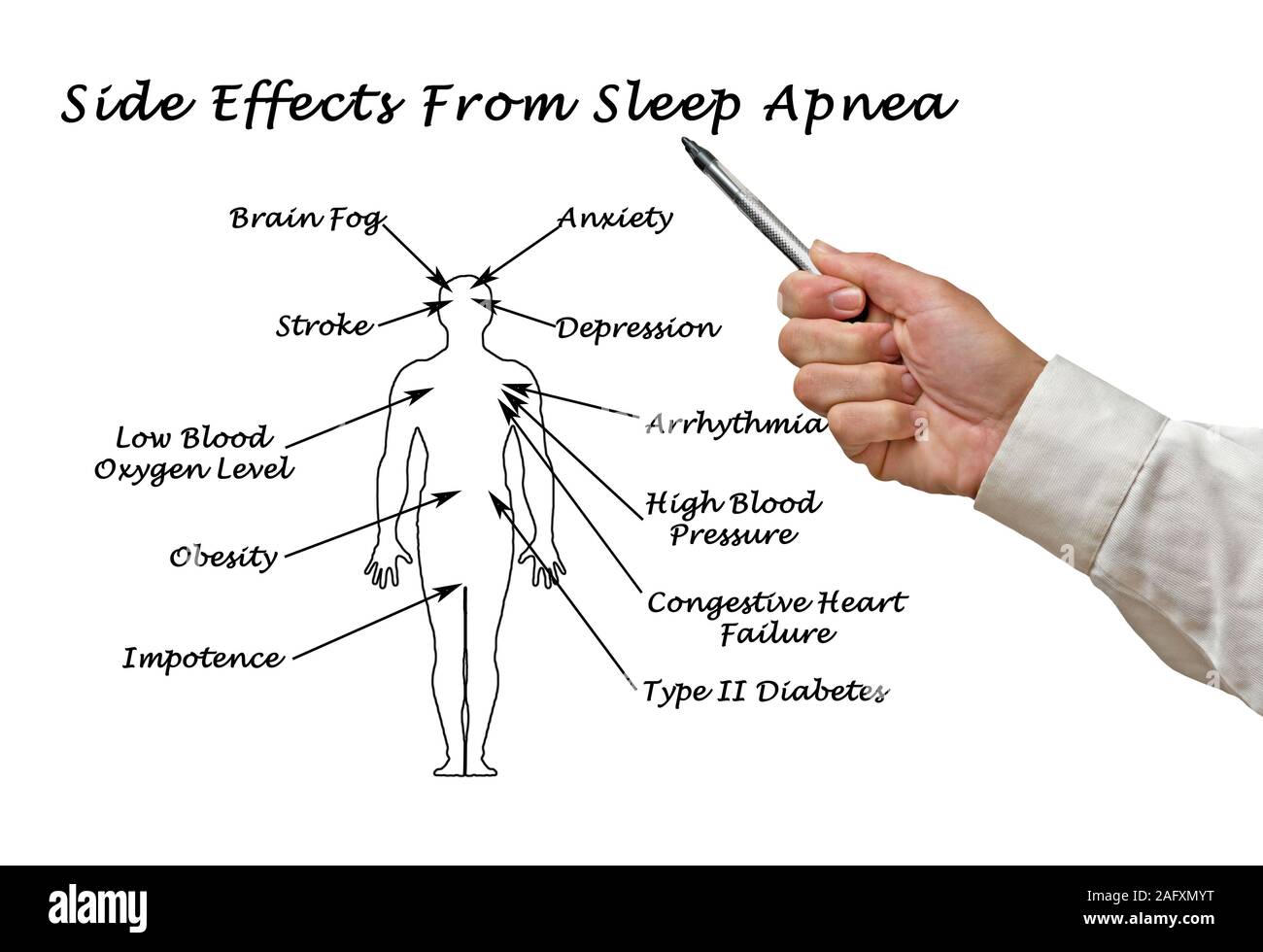 Side Effects From Sleep Apnea Stock Photo - Alamy