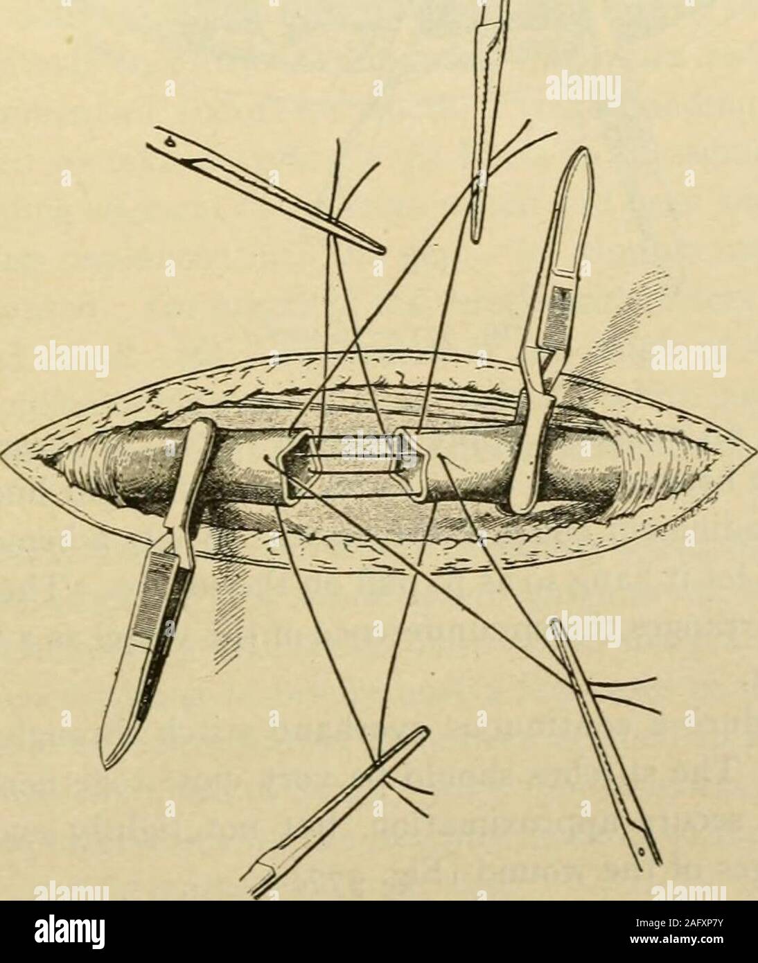 Dissecting forceps hi-res stock photography and images - Alamy