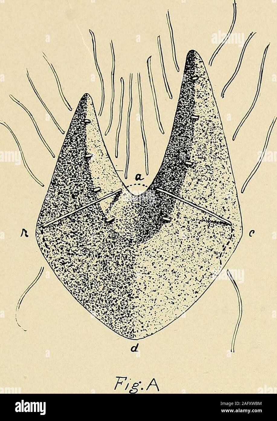 . The diagnosis and treatment of diseases of women. Crown Suture. The ...