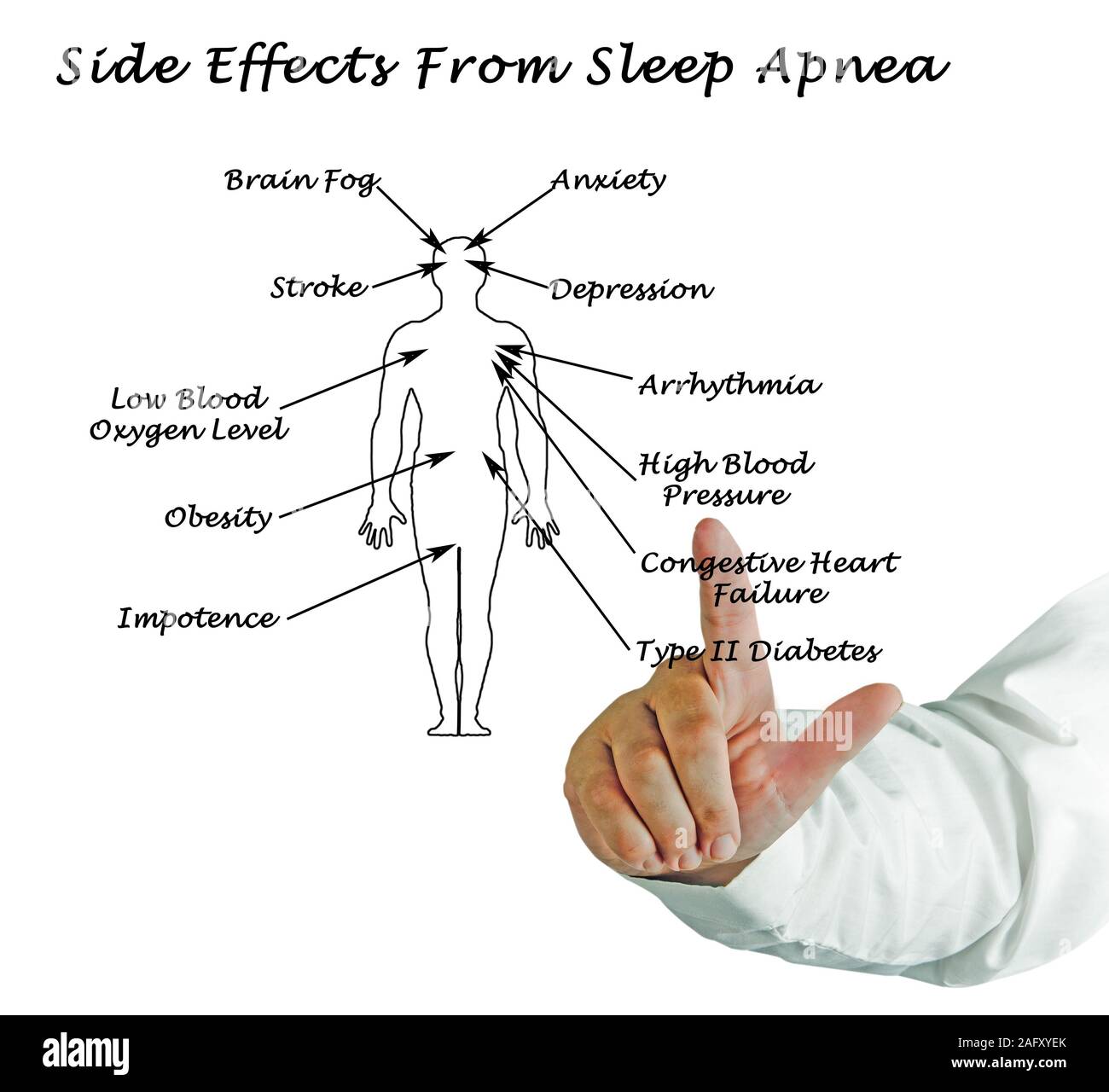 Side Effects From Sleep Apnea Stock Photo - Alamy