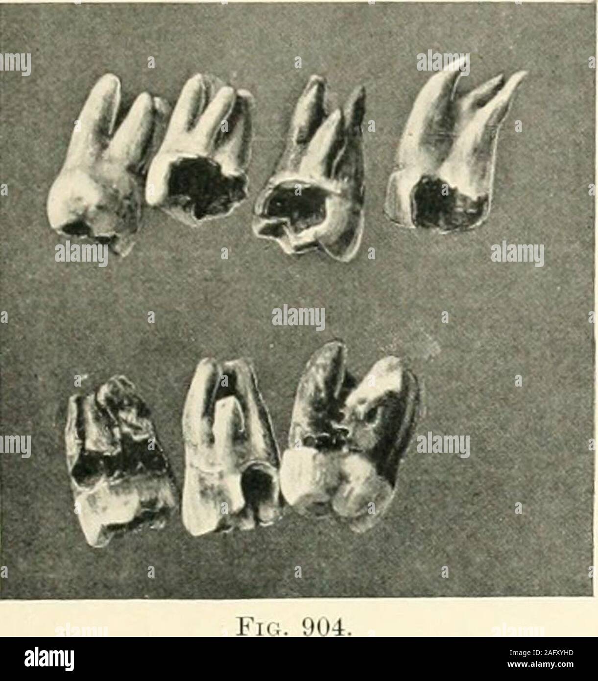 . The science and practice of dental surgery. Fig. 903. trismus may ...
