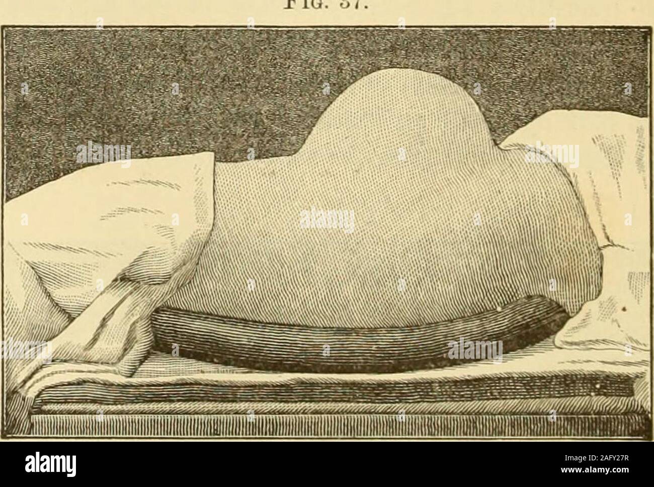 Palpate abdomen hi-res stock photography and images - Alamy