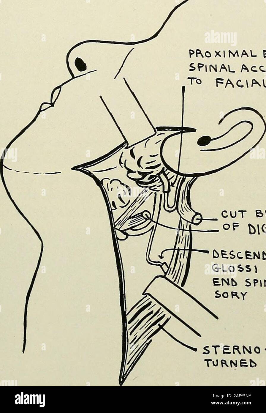 Stylomastoid foramen hi-res stock photography and images - Alamy