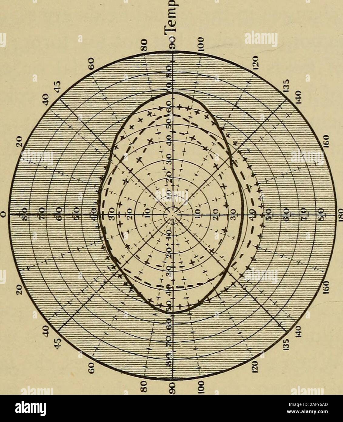 Visual field diagram hi-res stock photography and images - Alamy