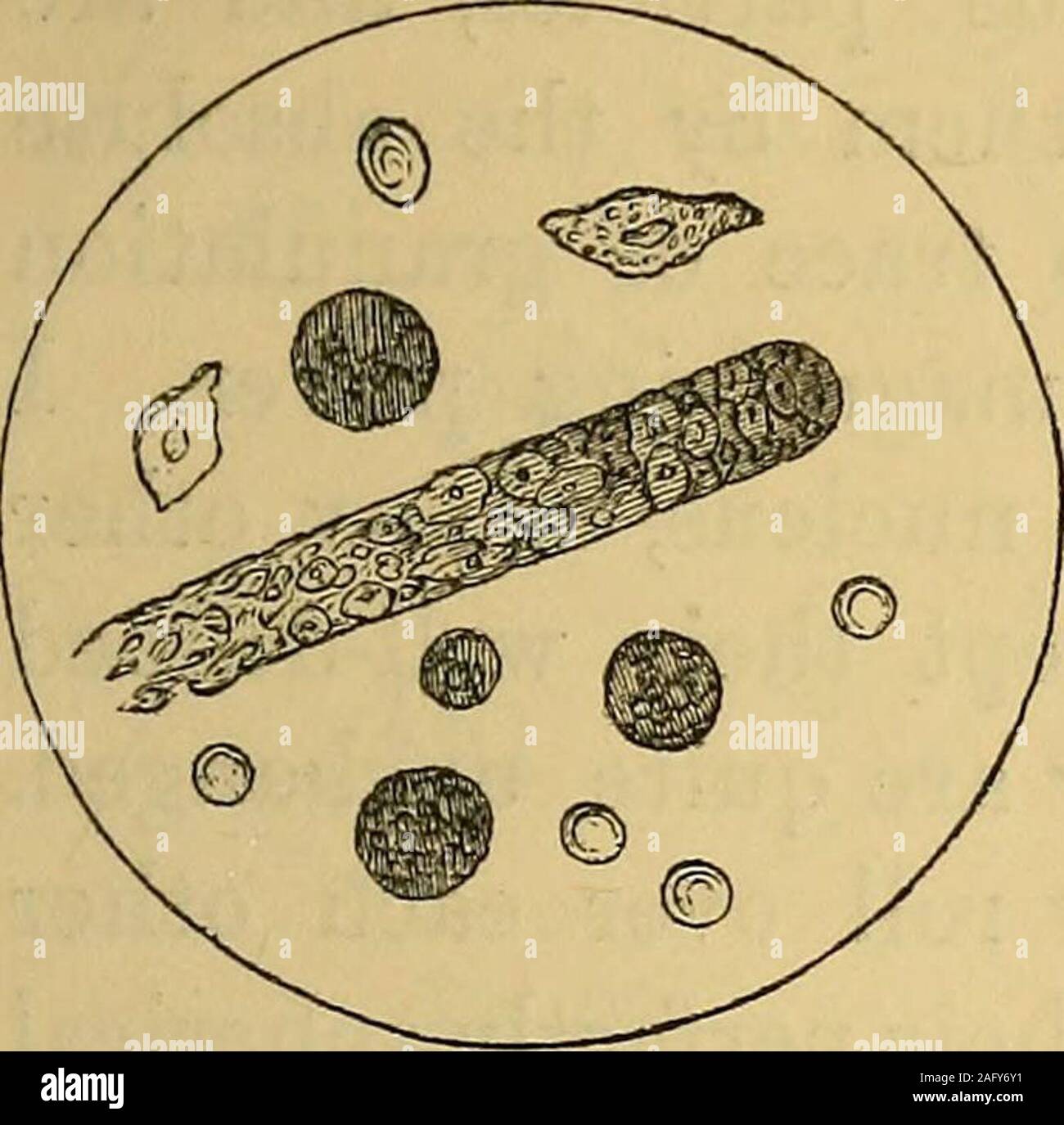 . Urinary deposits : their diagnosis, pathology, and therapeutical ...