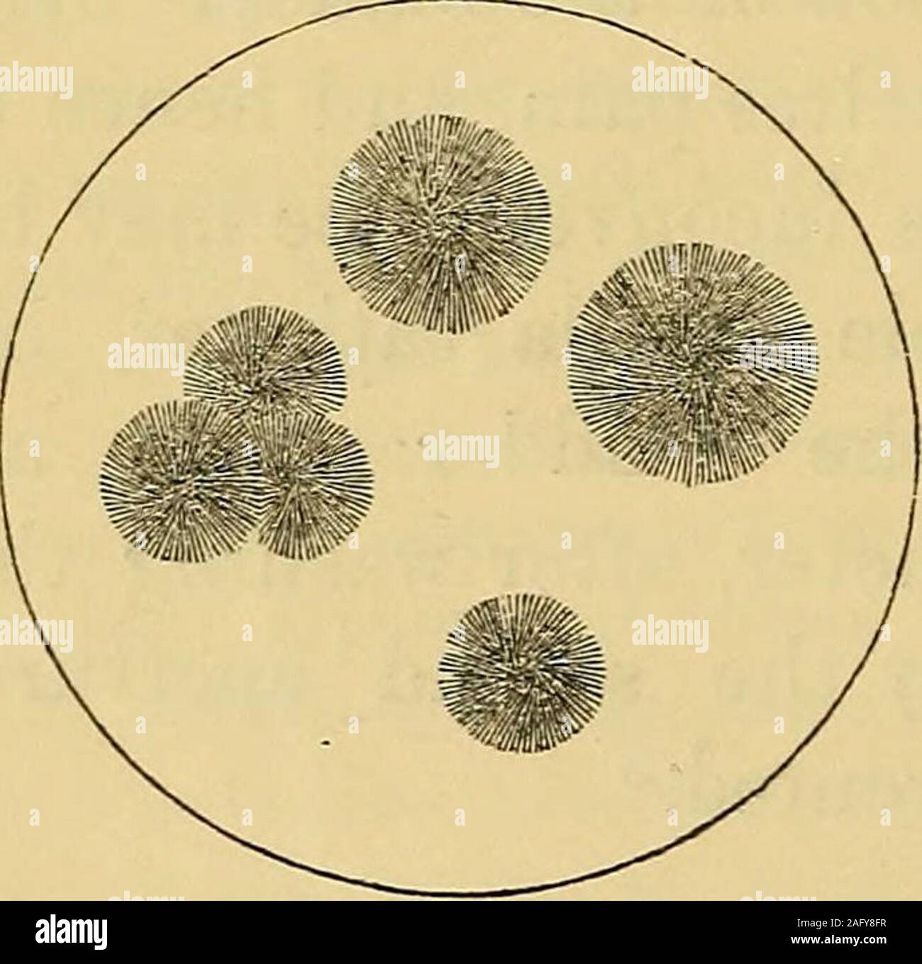 . Urinary deposits : their diagnosis, pathology, and therapeutical ...