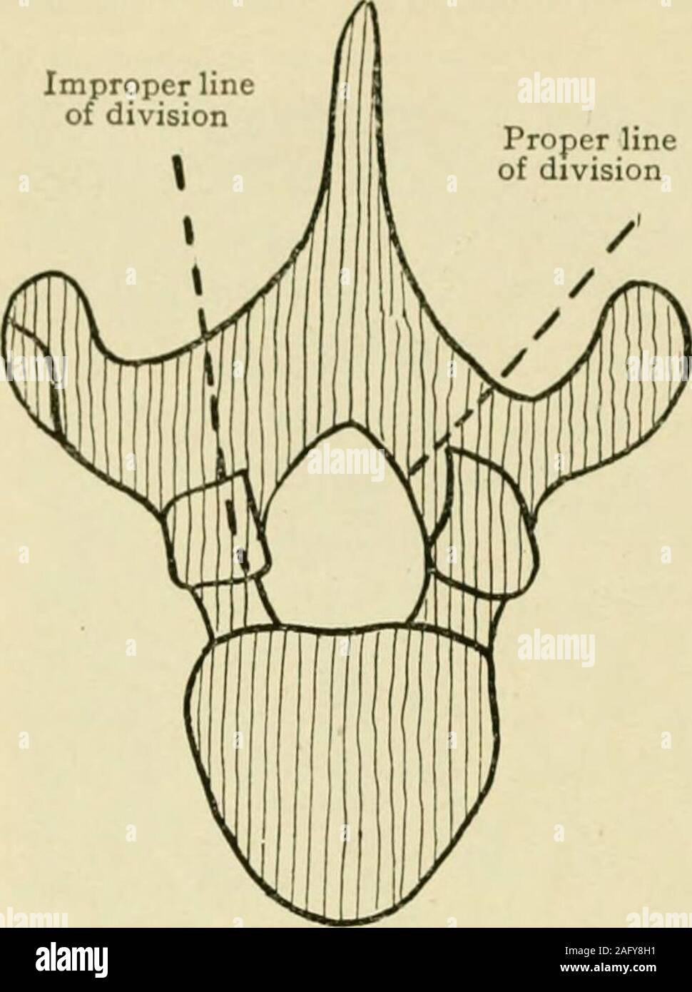 . Manual of operative surgery. cisterns. {Murphyafter Poirier.) 760 ...