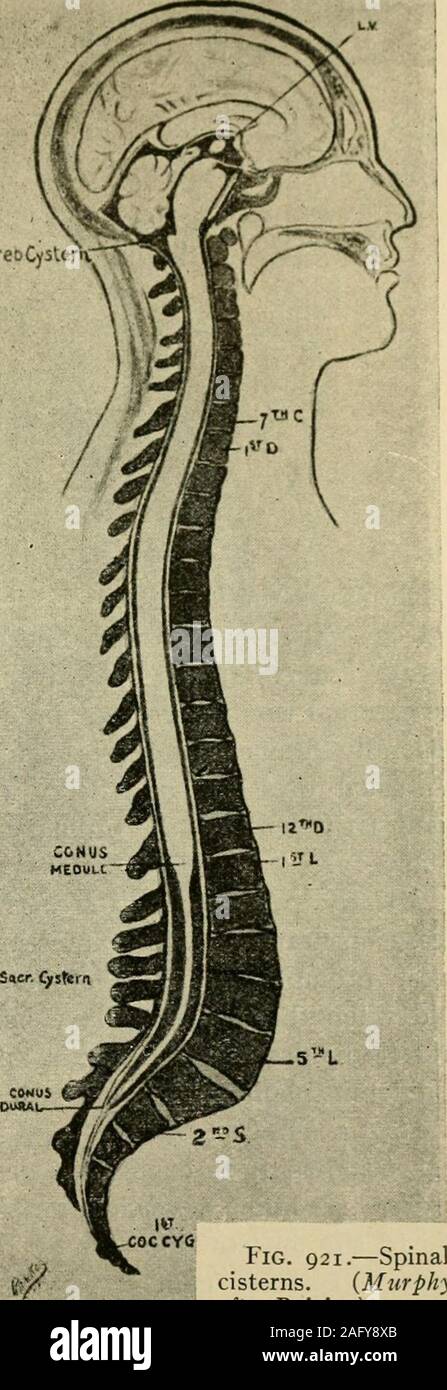. Manual of operative surgery. e spinousprocesses. This cut reaches ...