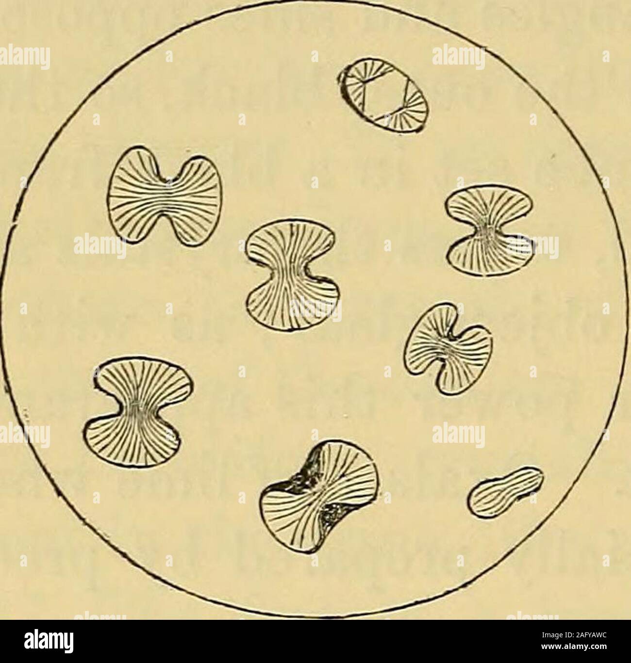 . Urinary deposits : their diagnosis, pathology, and therapeutical ...