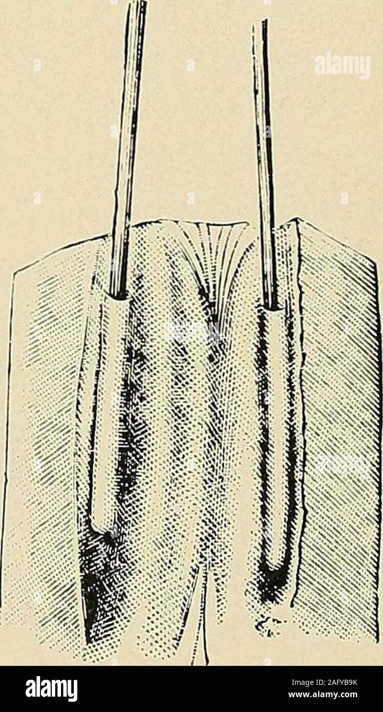 Skenes Glands