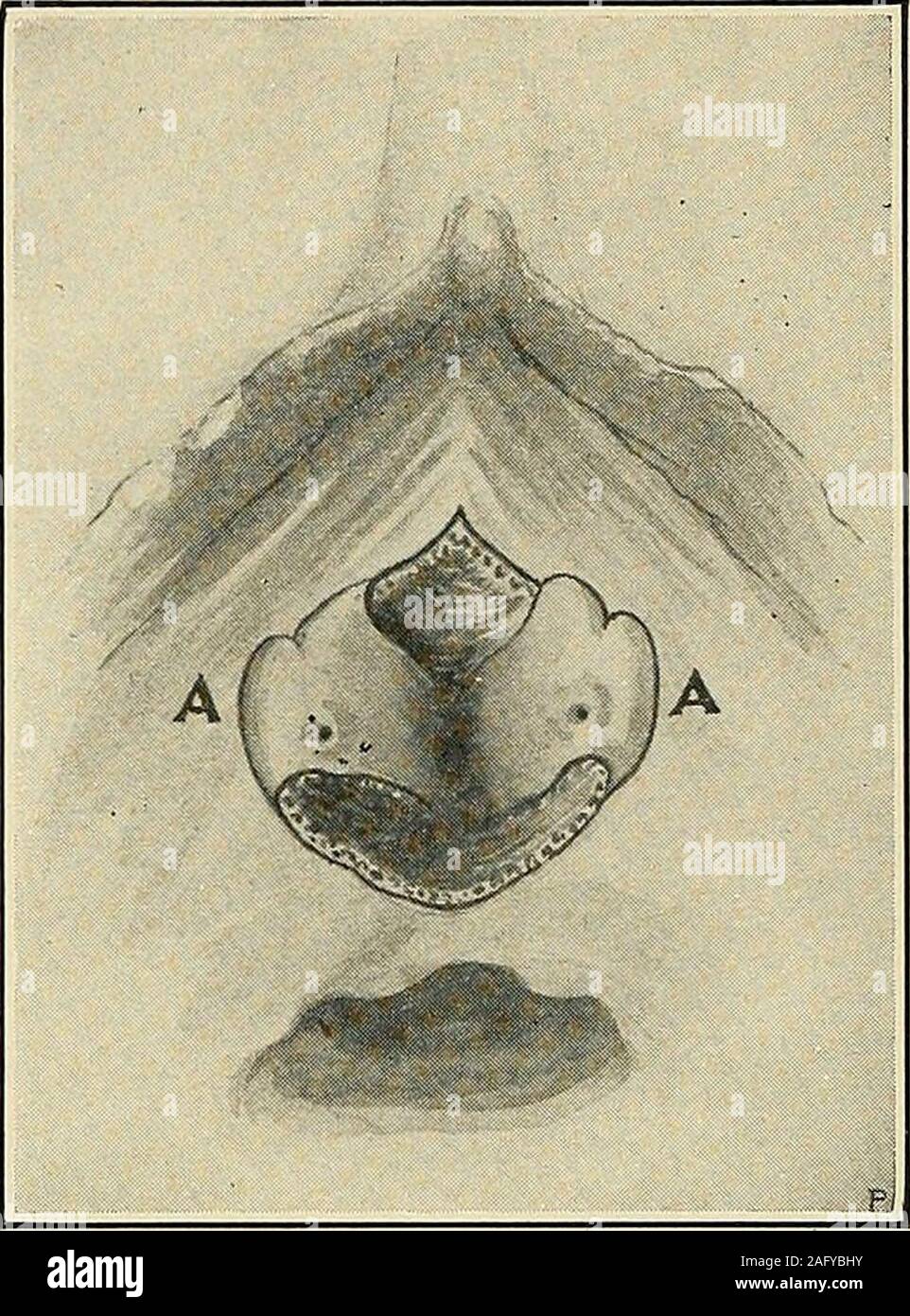 . The diagnosis and treatment of diseases of women. Fig. 474. Cross ...
