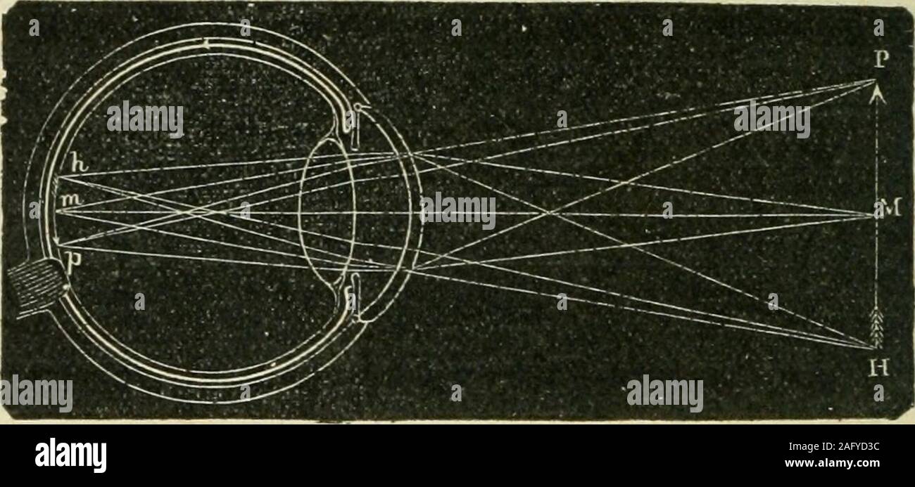 Eye deviation hi-res stock photography and images - Alamy