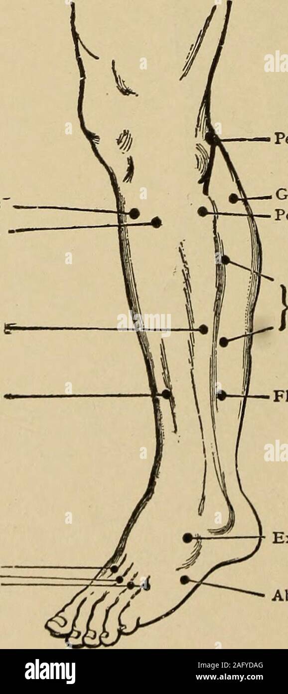 . A treatise on the nervous diseases of children, for physicians and ...