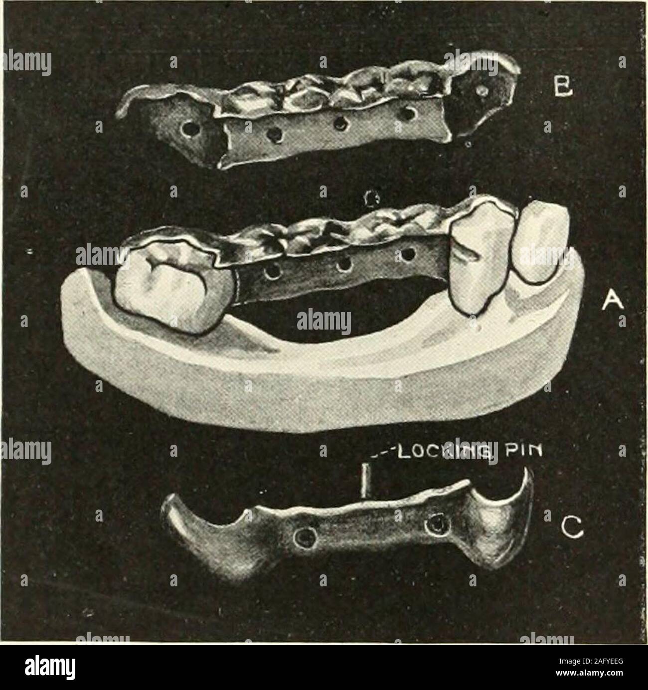 . The science and practice of dental surgery. Fig. 851.—Case 3.. Case 3 ...