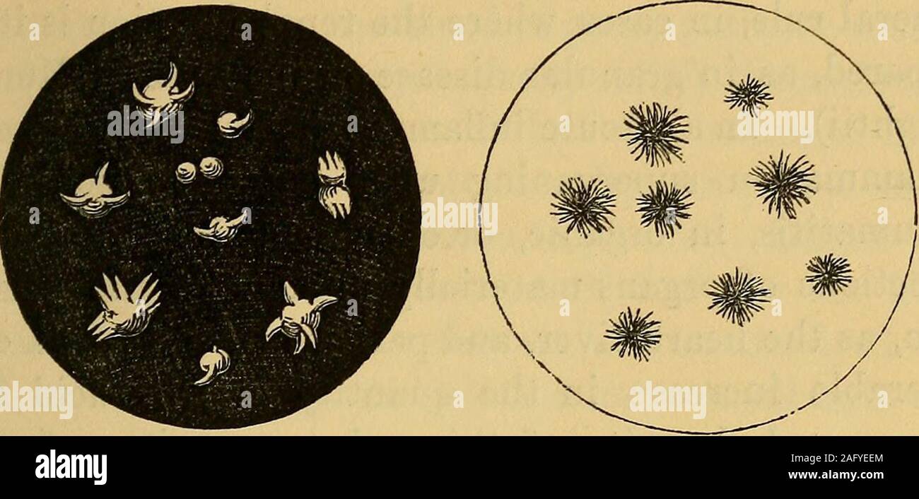 . Urinary deposits : their diagnosis, pathology, and therapeutical ...