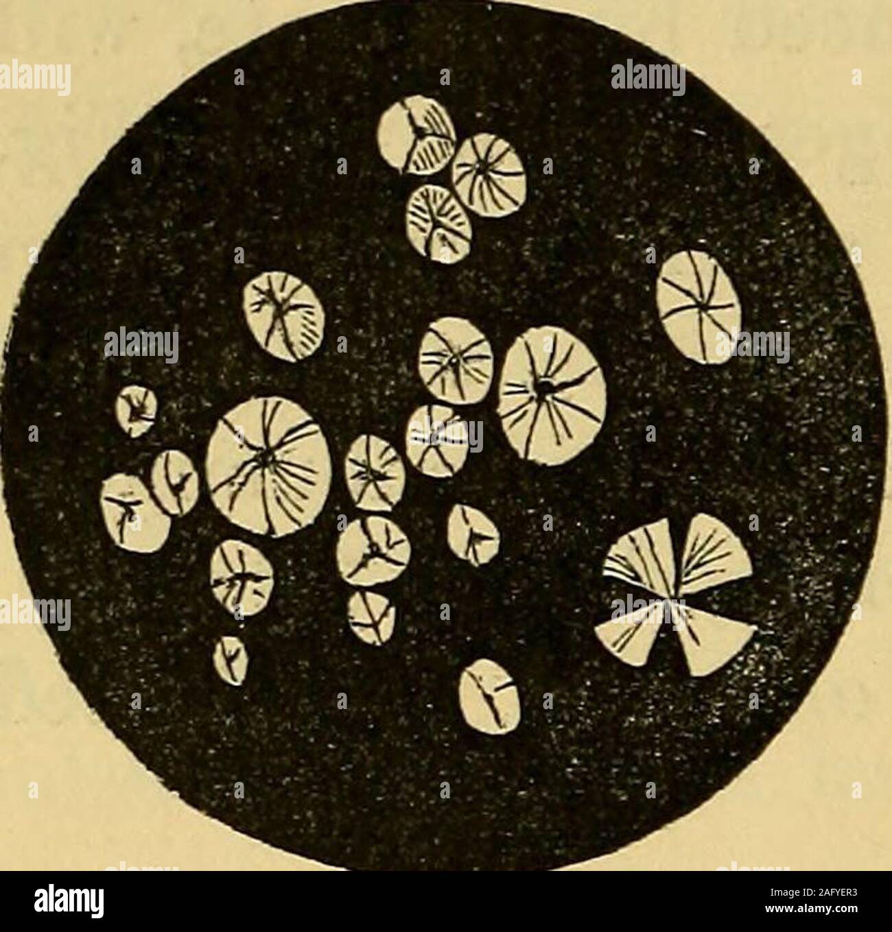 . Urinary deposits : their diagnosis, pathology, and therapeutical ...