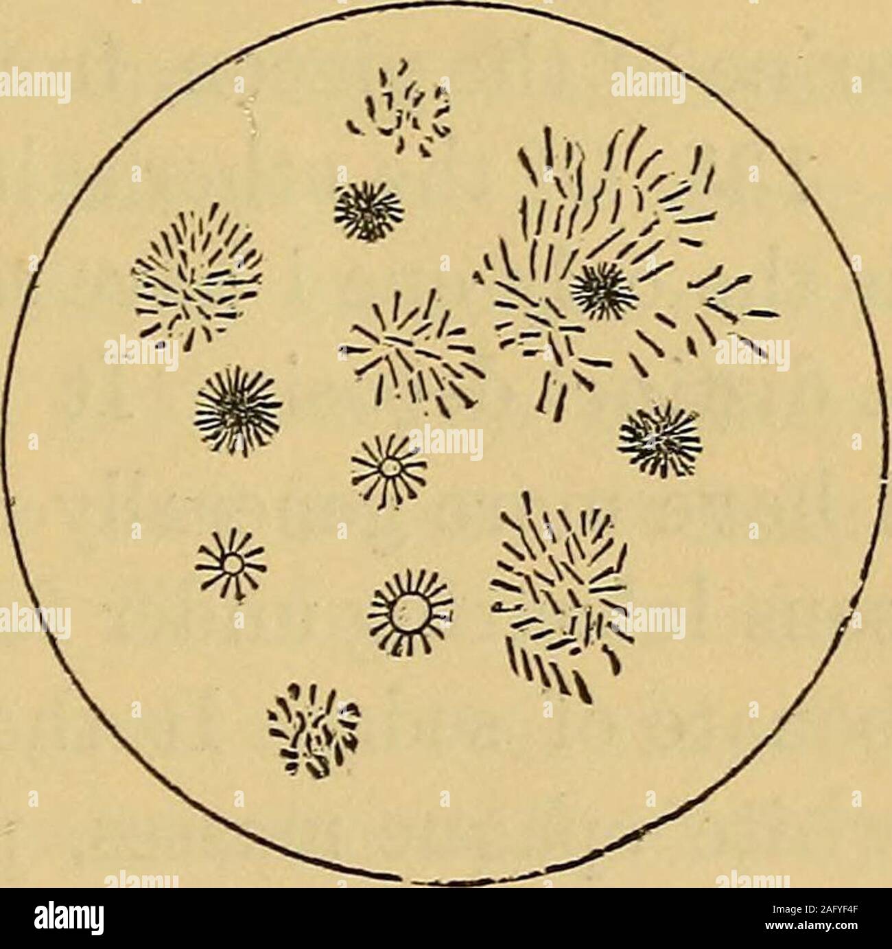 . Urinary deposits : their diagnosis, pathology, and therapeutical ...