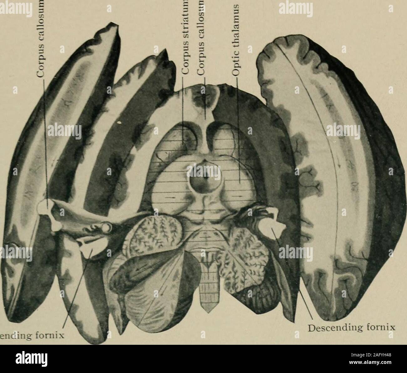 Fornix of the brain hi-res stock photography and images - Alamy