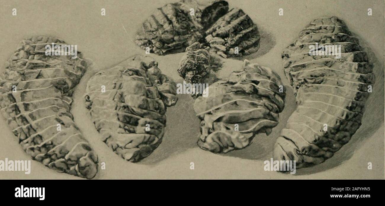 Brain pathology cerebellum hi-res stock photography and images - Alamy