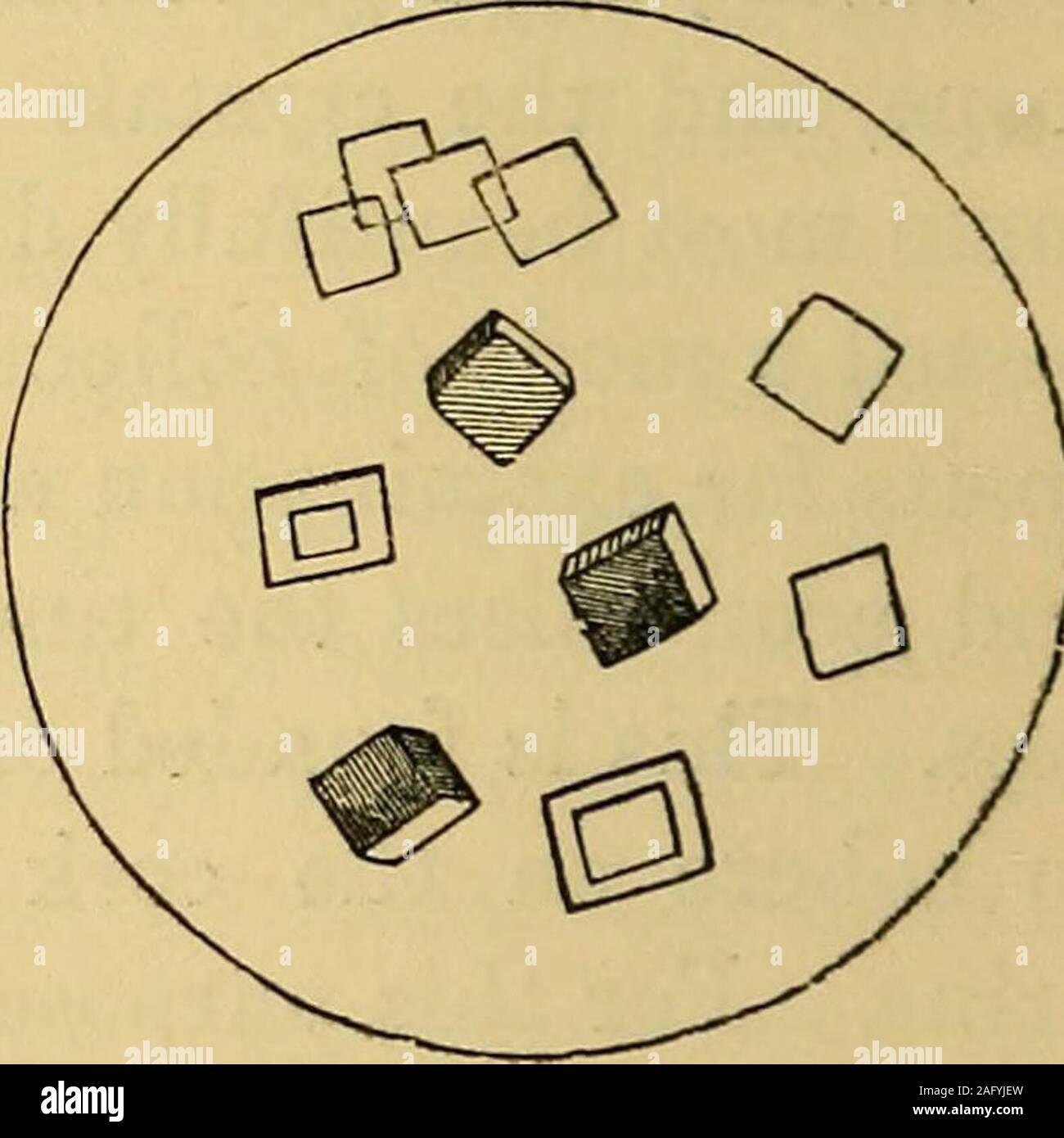 Urinary crystal hi-res stock photography and images - Alamy