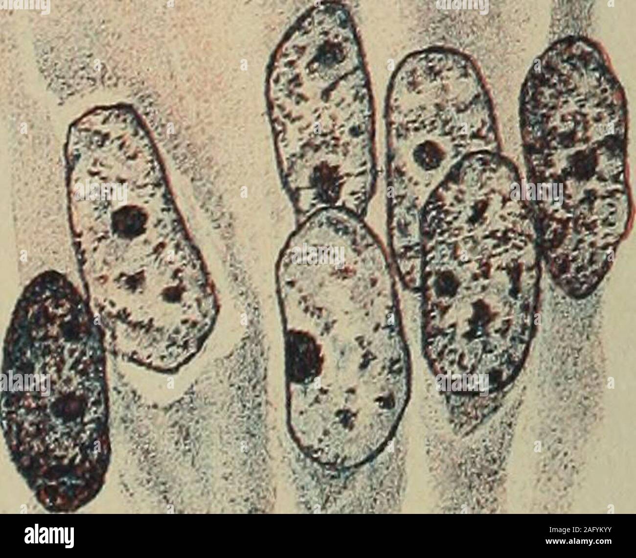 . Medical and surgical reports. Mallory Pertussis HISTOLOGICAL LESION ...