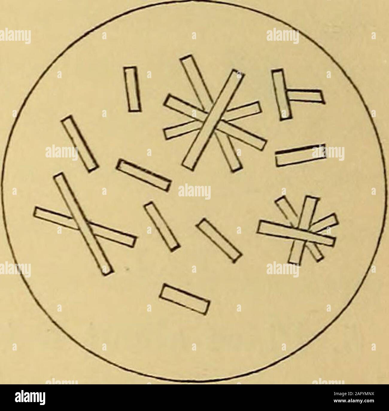 Hippuric acid crystals hi-res stock photography and images - Alamy